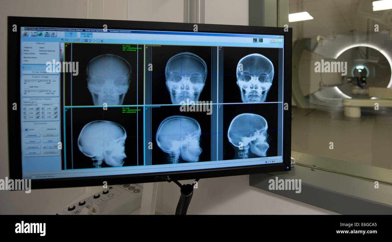 Dresden, Germany. 22nd Aug, 2014. The method of the protons treatment ...