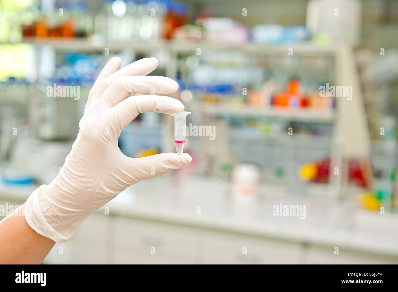 Hand in glove holding tube with biochemistry test for indole detection ...