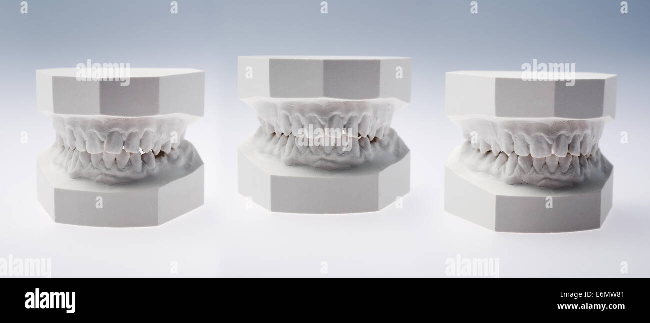 Plaster models hi-res stock photography and images - Alamy