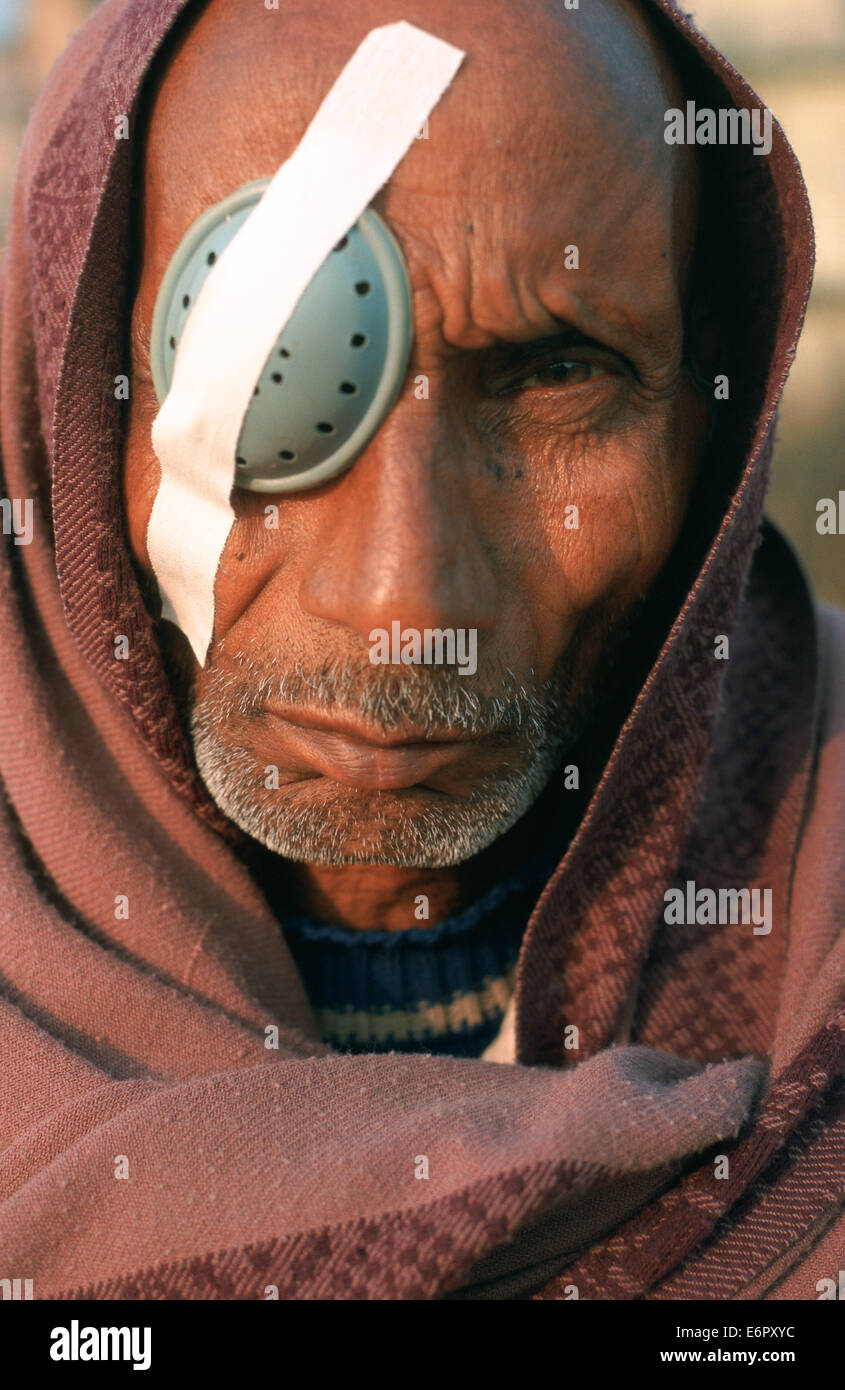 Cataract surgery india hi-res stock photography and images - Alamy
