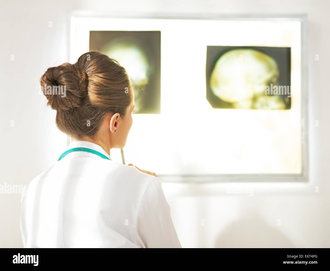 Doctor woman looking on fluorography. rear view Stock Photo - Alamy