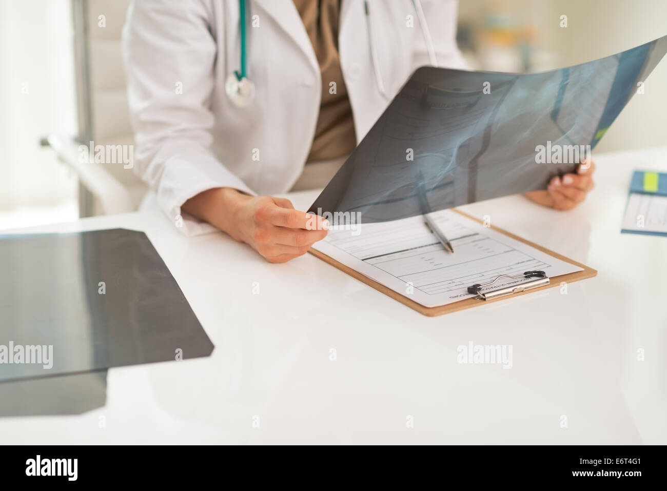Closeup on doctor woman holding fluorography Stock Photo - Alamy