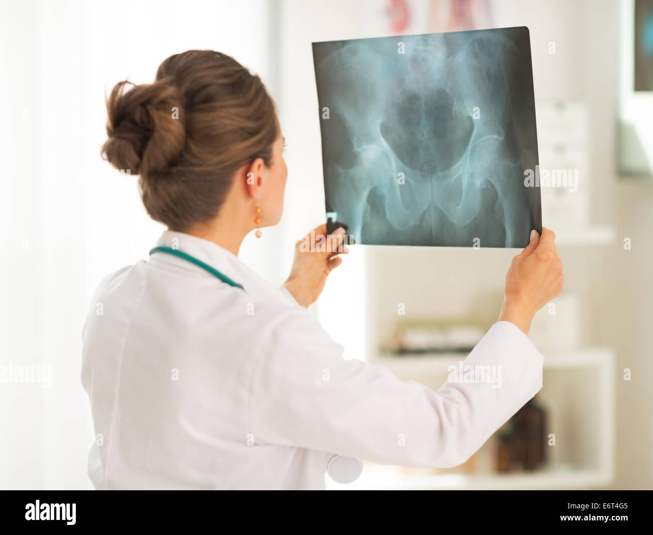 Doctor woman looking on fluorography. rear view Stock Photo - Alamy