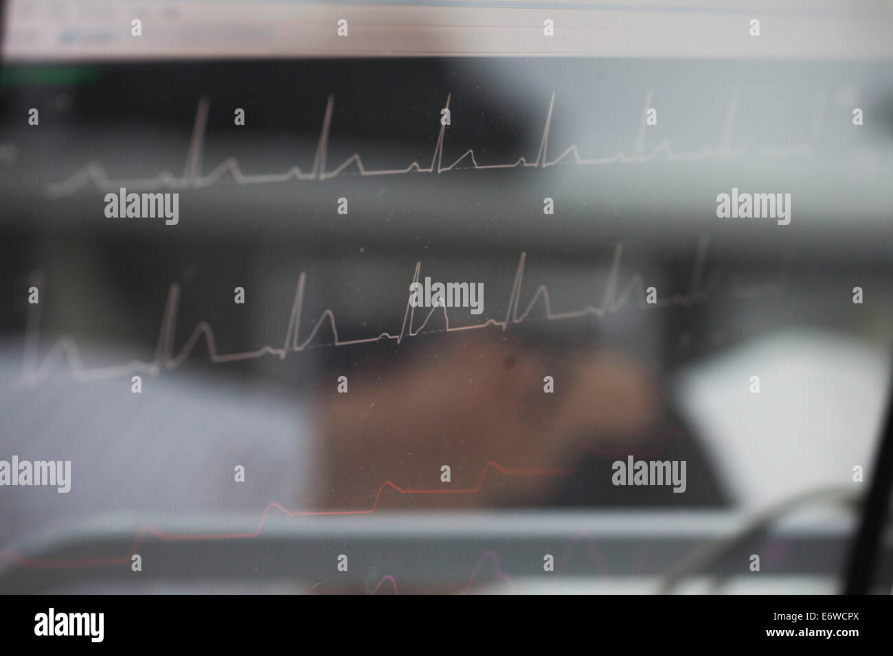 close up of heart monitor with metiman simulator in background Stock ...