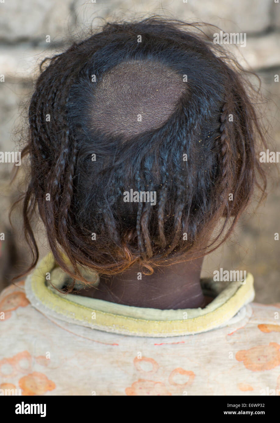 Afar Tribe Girl With Tonsure On The Head To Protect Her From The Bad ...