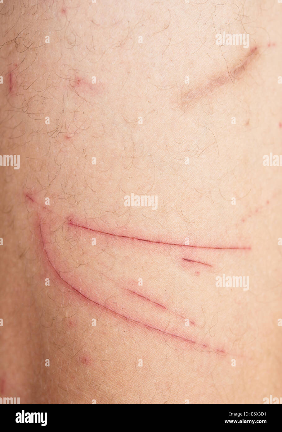 Slough skin hi-res stock photography and images - Alamy