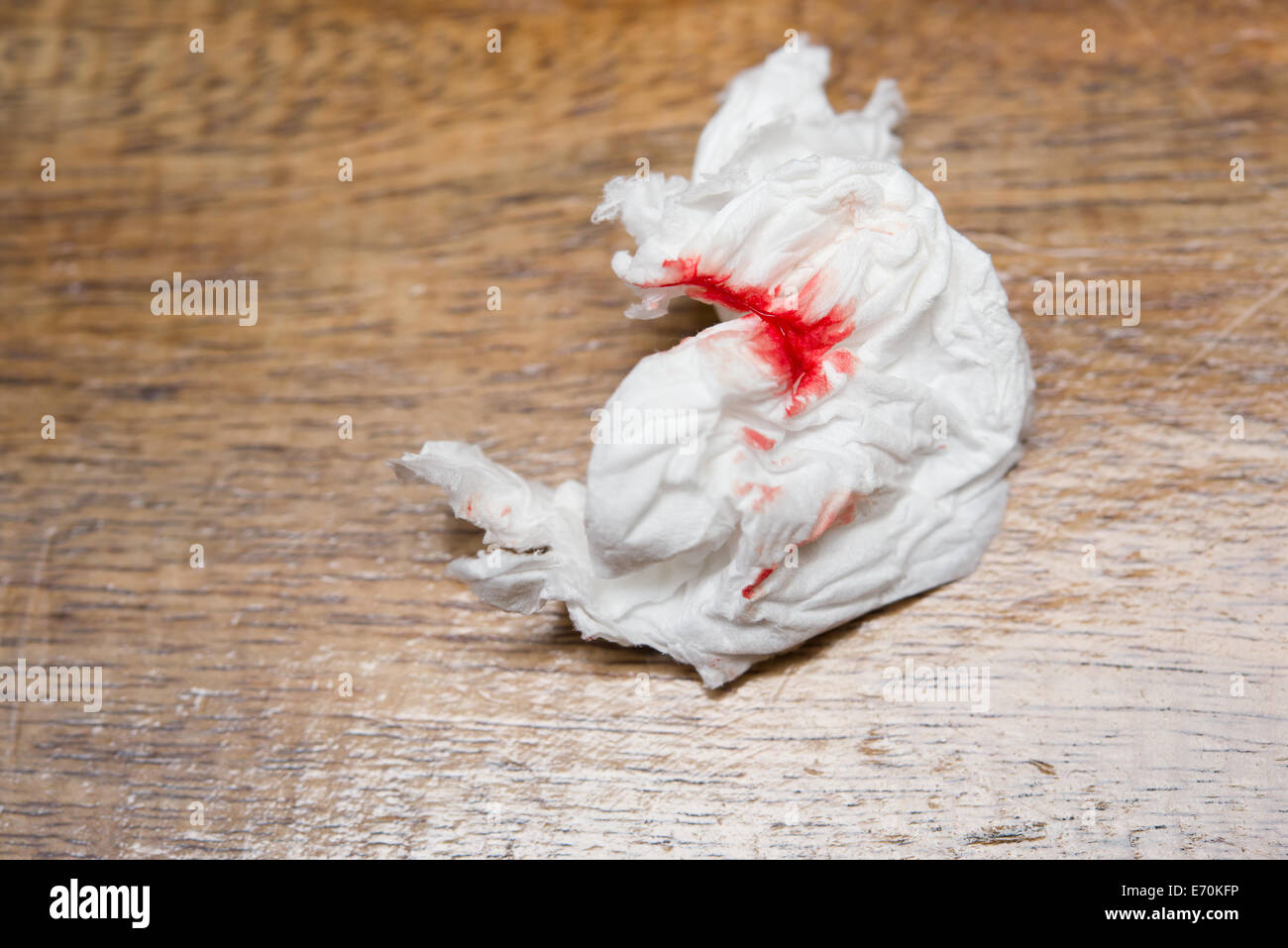 Tissue pain hi-res stock photography and images - Alamy