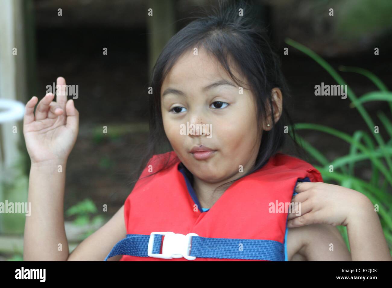 Cute young girl with scratches on her nose and lip from a fall, having ...