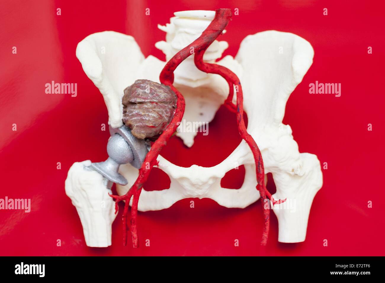 3d printing pelvis model hi-res stock photography and images - Alamy