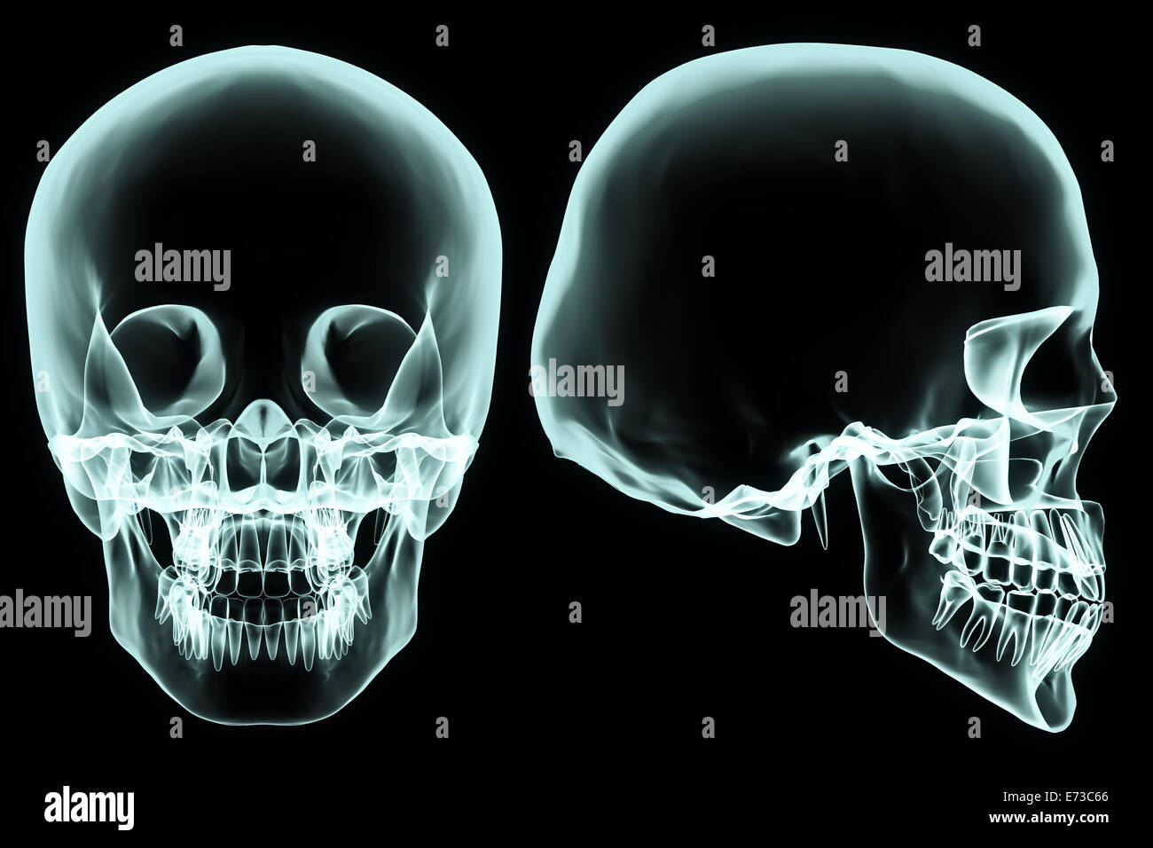 X-ray front and side skull in brightness blue with black background ...