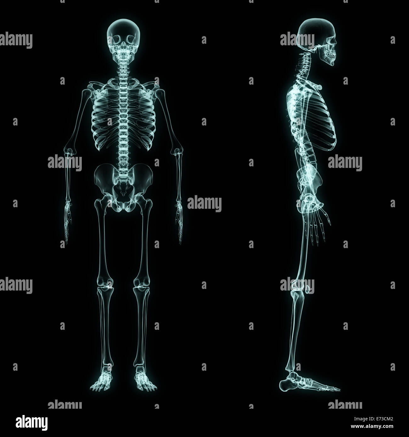 X-ray full body of skeleton in brightness blue with black background ...