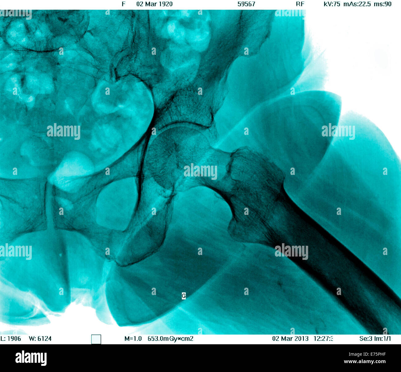 Female pelvis and hips hi-res stock photography and images - Alamy