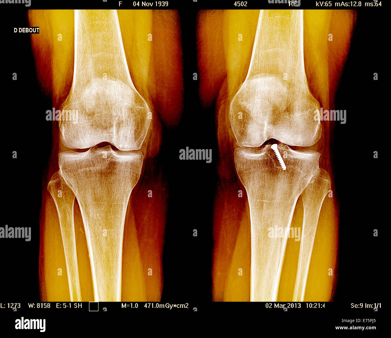 Female skeletal joints hi-res stock photography and images - Alamy