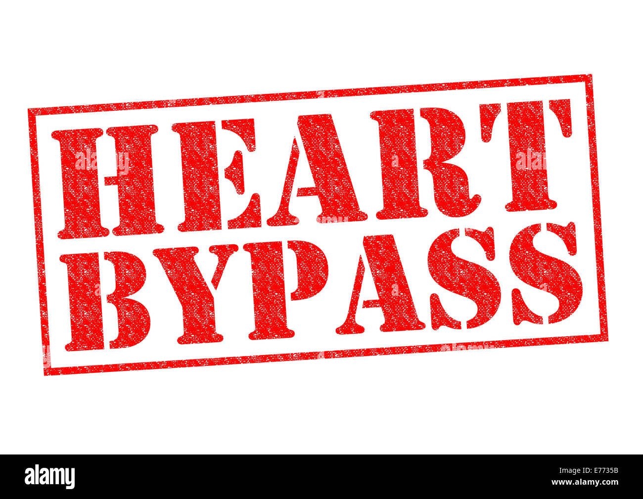 Coronary artery bypass graft hi-res stock photography and images - Alamy