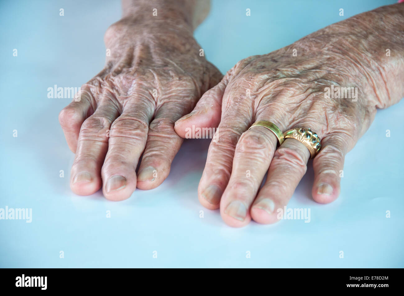 old woman hand with wedding ring Stock Photo - Alamy