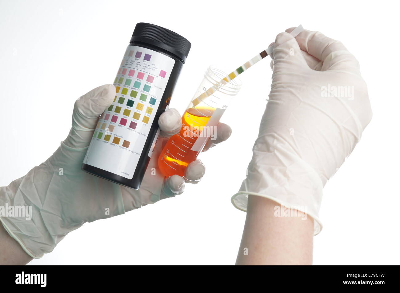 Urine test stripes examined by a nurse. Lab sample Stock Photo - Alamy