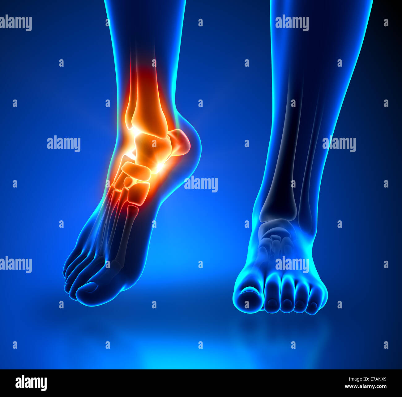 Ankle pain - detail Stock Photo - Alamy