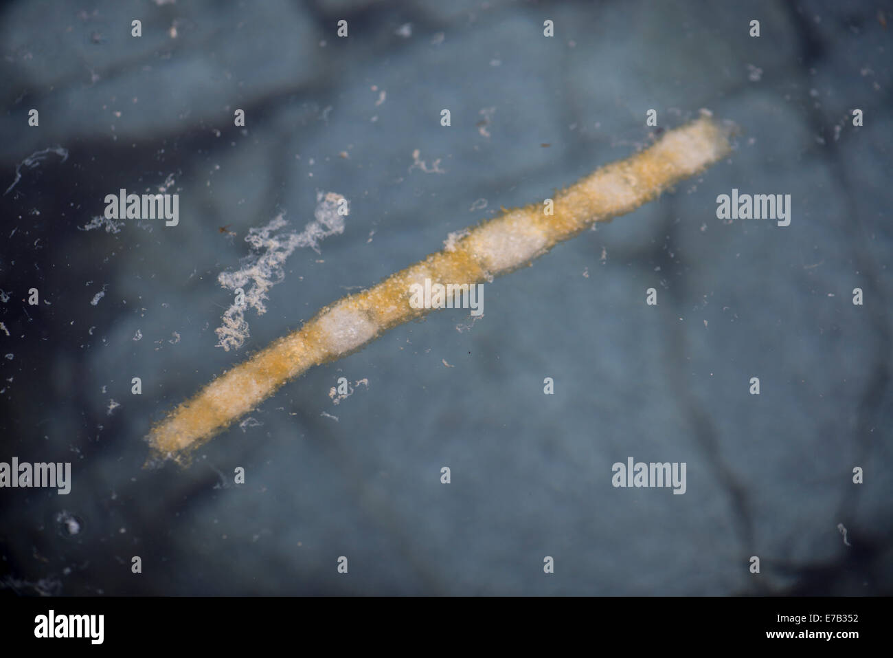 Nematode hi-res stock photography and images - Alamy