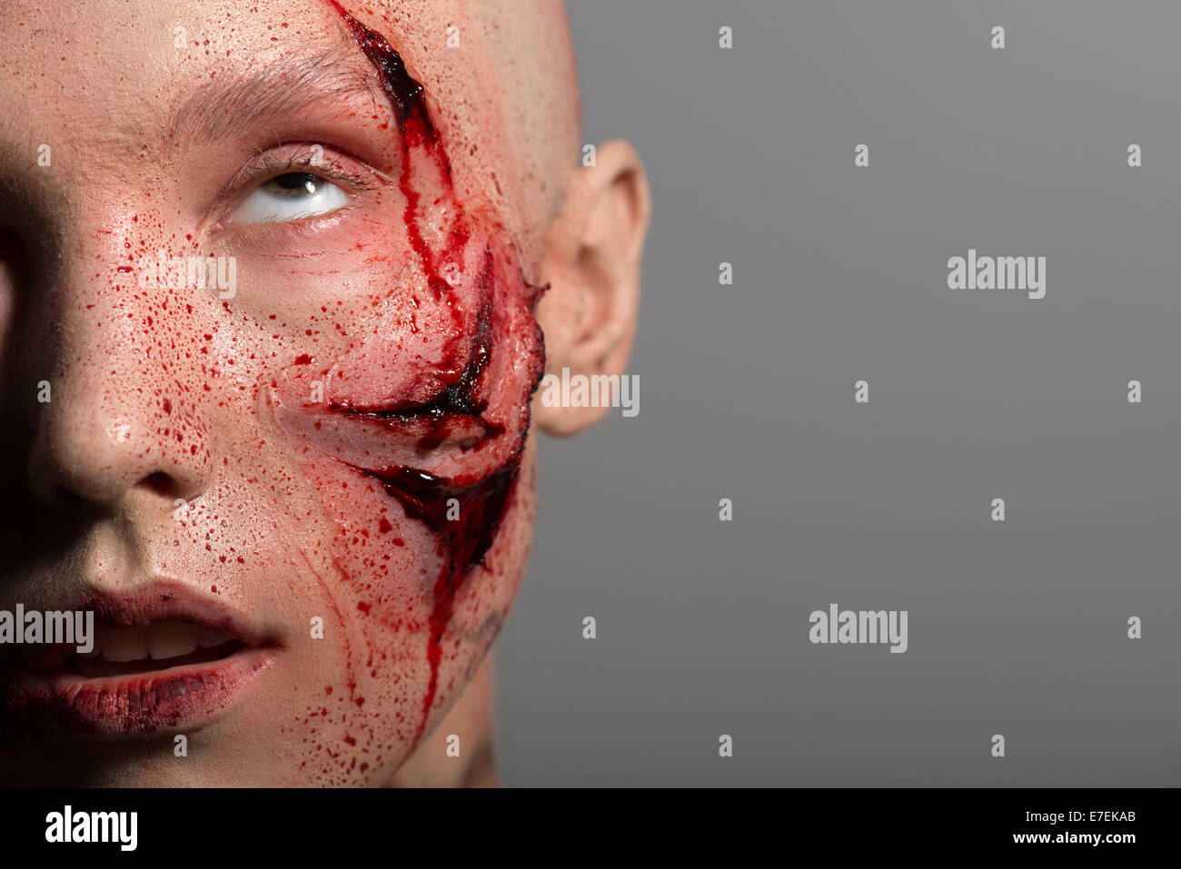 Woman with the gash prepared for operation Stock Photo - Alamy