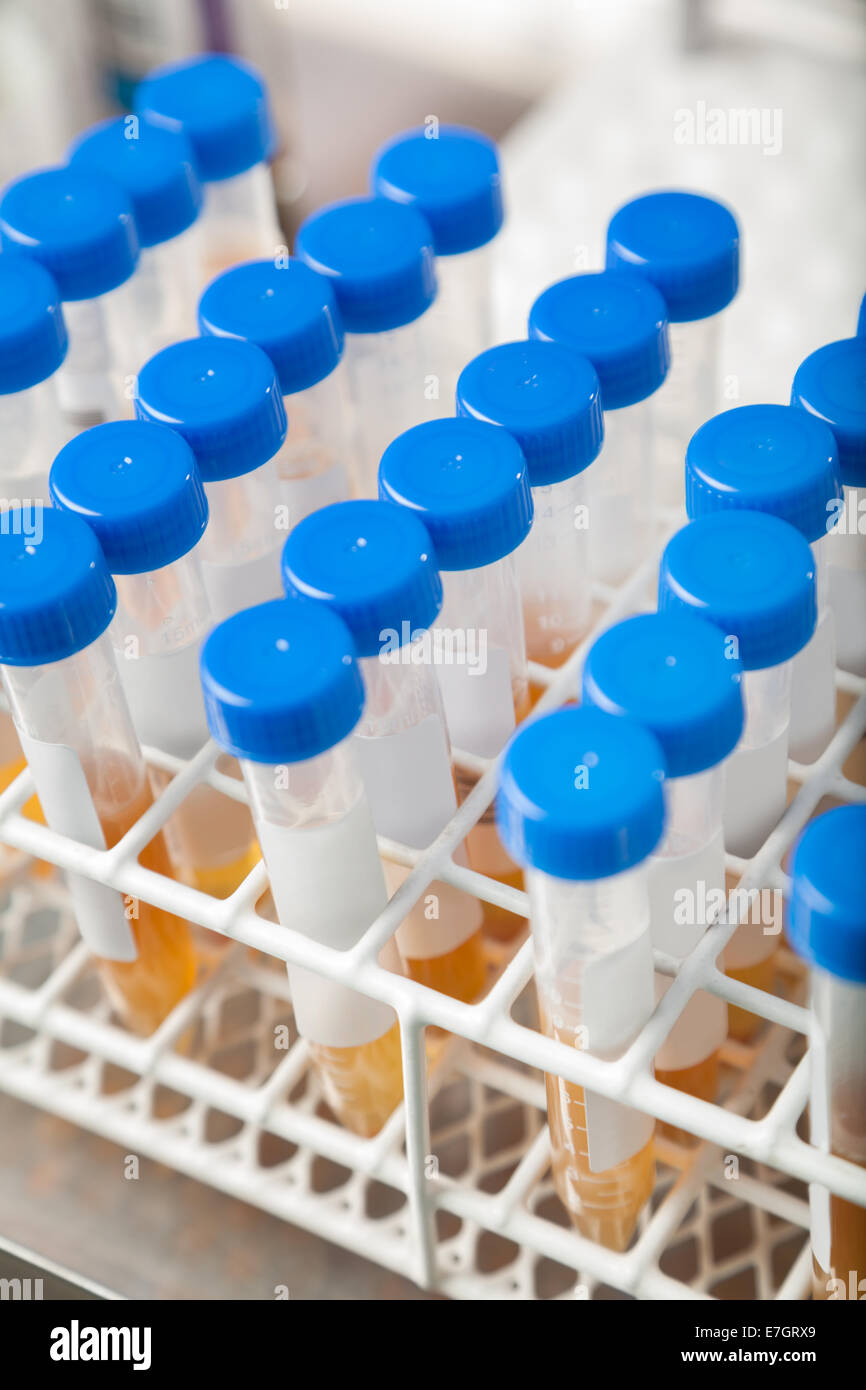 Test Tubes In Medical Laboratory Stock Photo - Alamy