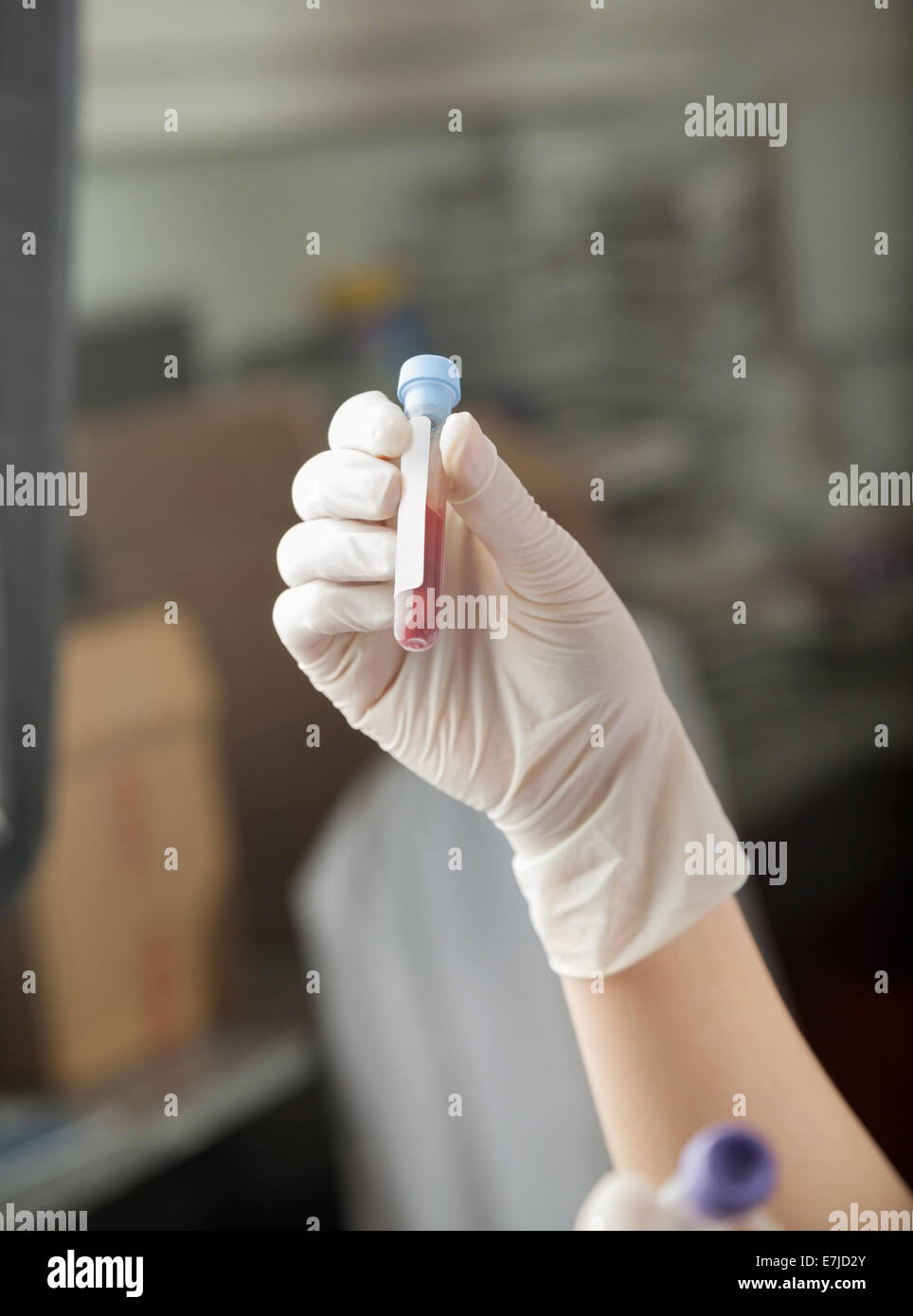 Lab technician holding blood sample hi-res stock photography and images ...