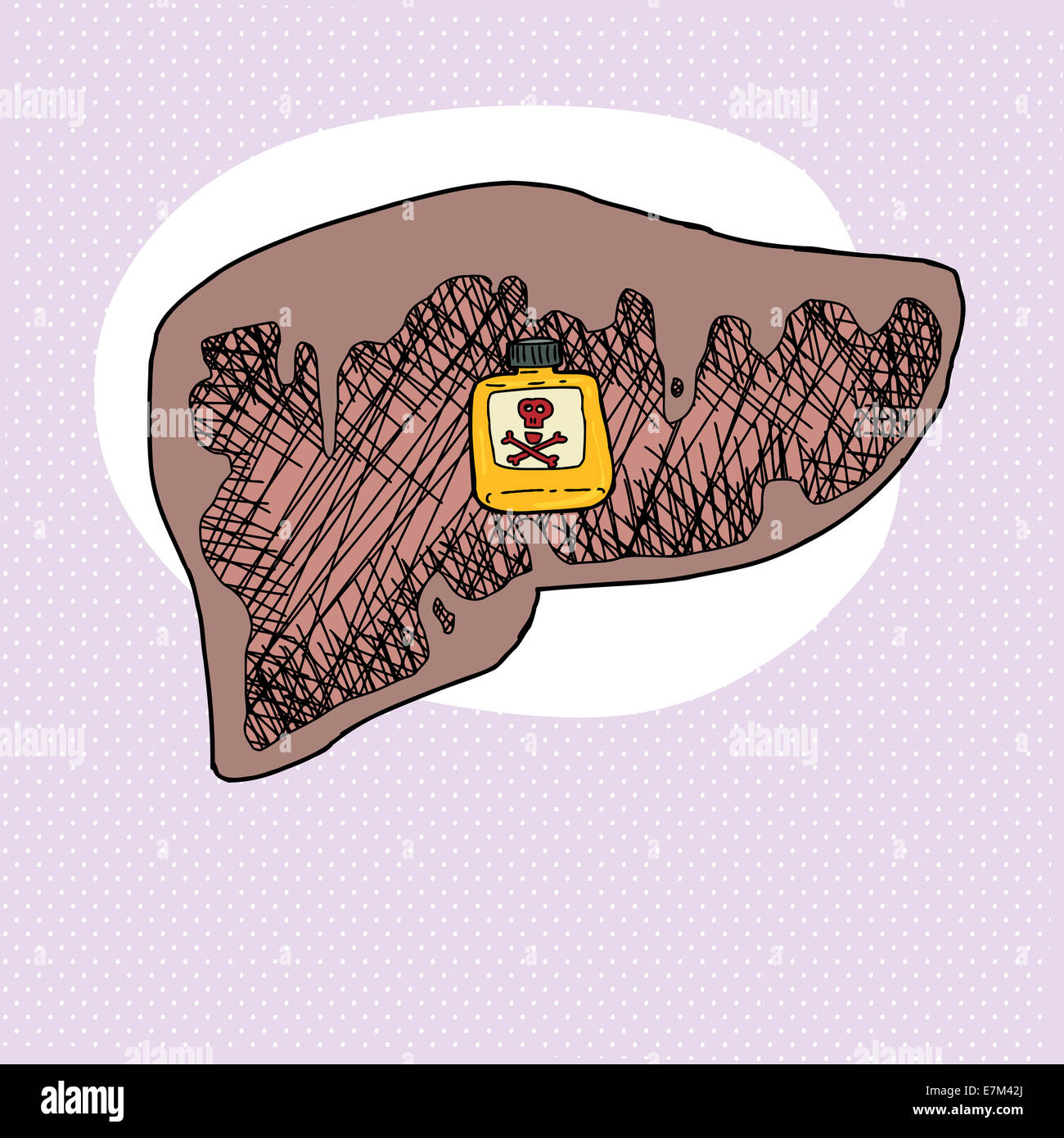 Diagram of rotting human liver organ with whiskey bottle Stock Photo ...