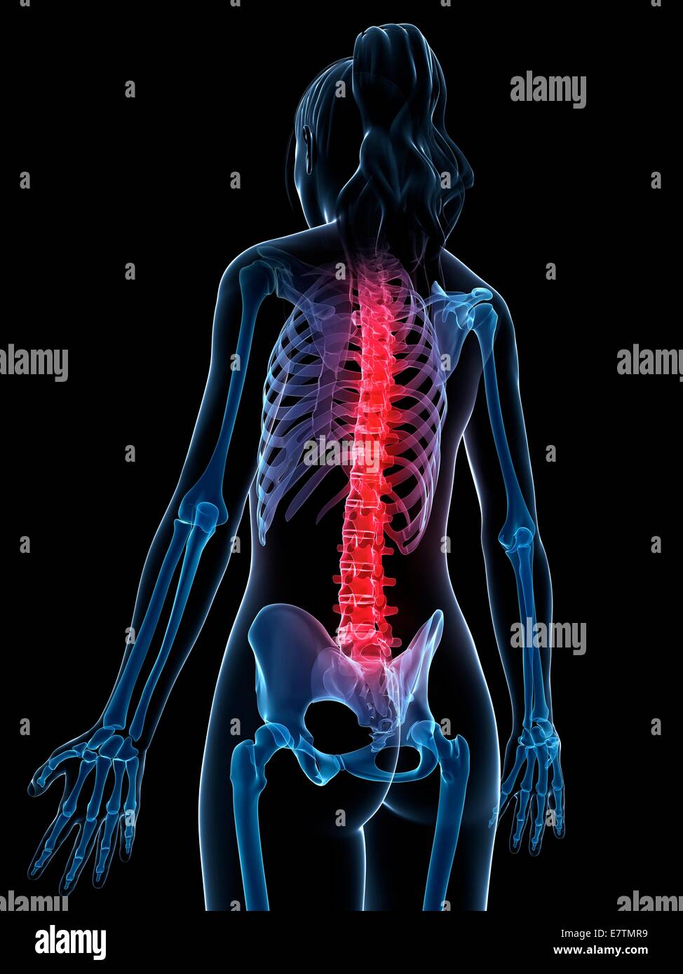 Human back pain, computer artwork Stock Photo - Alamy