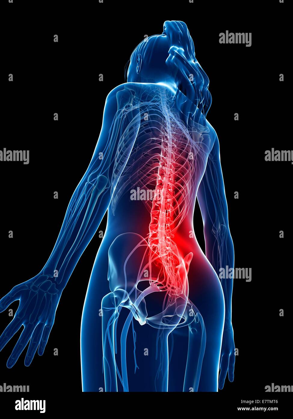 Human back pain, computer artwork Stock Photo - Alamy