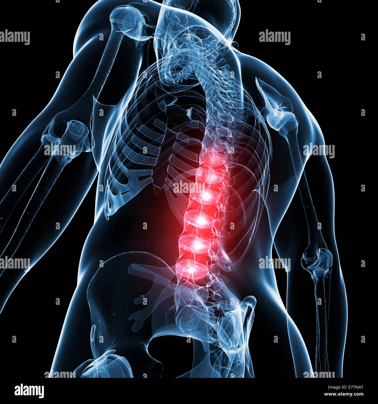 Lower spine hi-res stock photography and images - Alamy