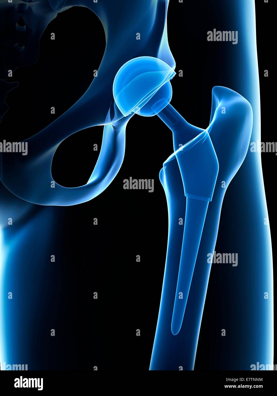 Human replacement hi-res stock photography and images - Alamy