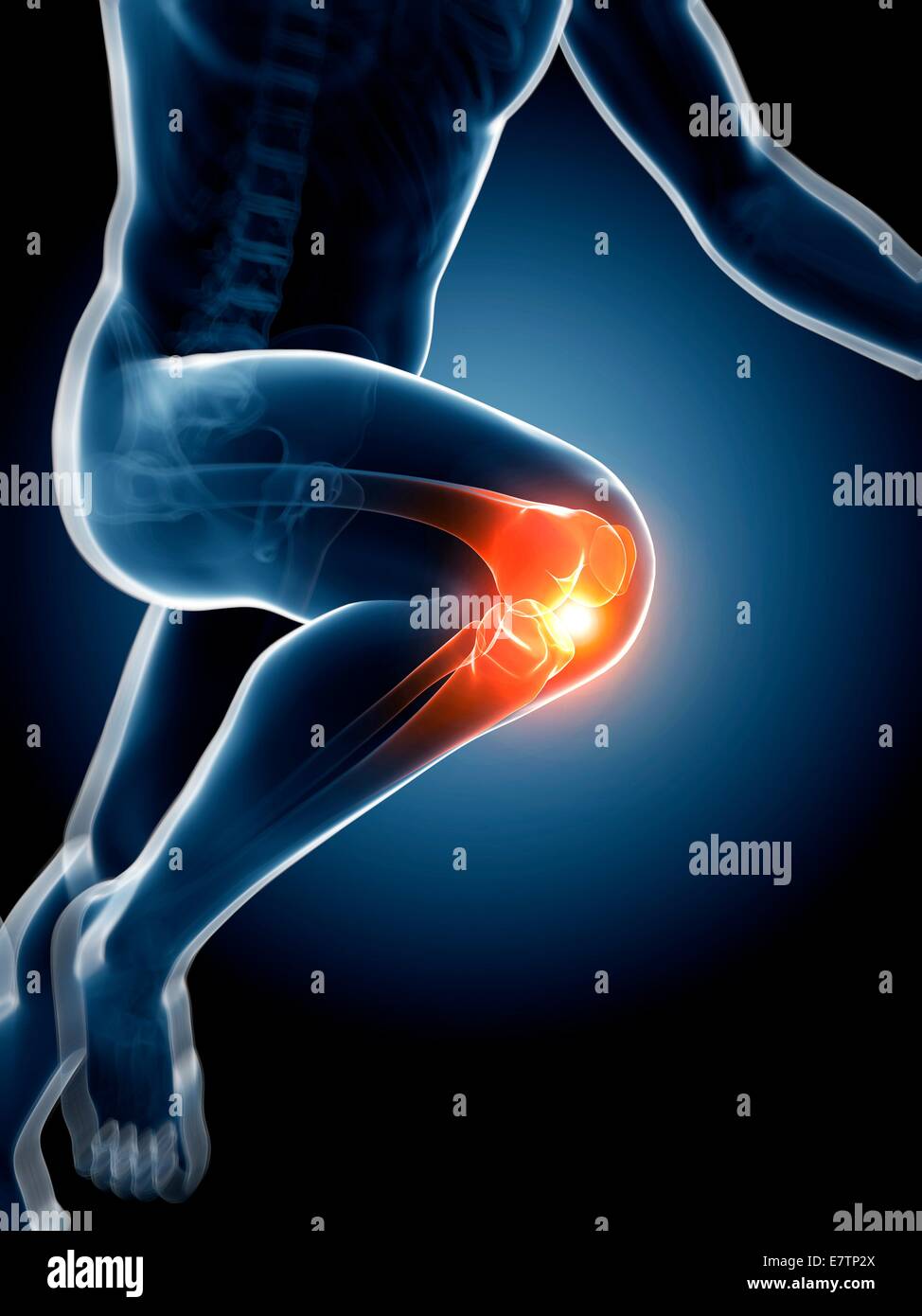 Human anatomy of a runner's knee joint, computer artwork Stock Photo ...