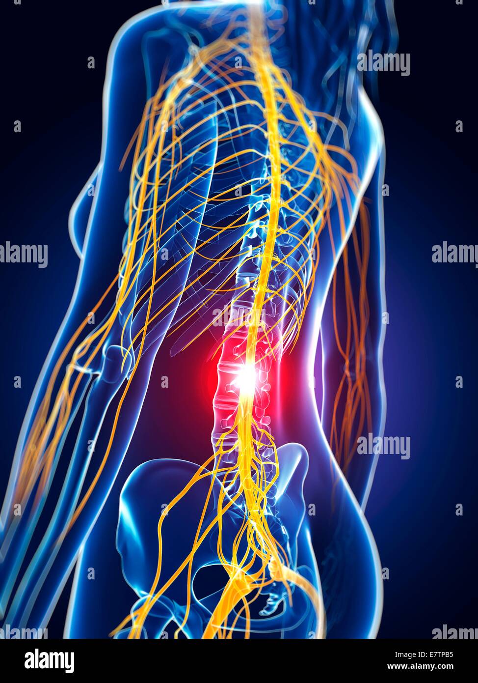 Nerve pain hi-res stock photography and images - Alamy