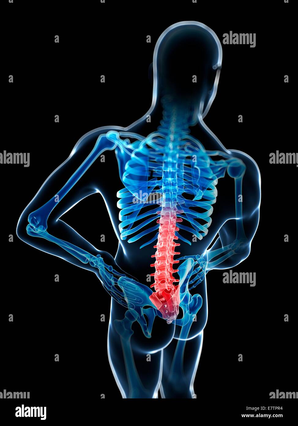 Human back pain, computer artwork Stock Photo - Alamy