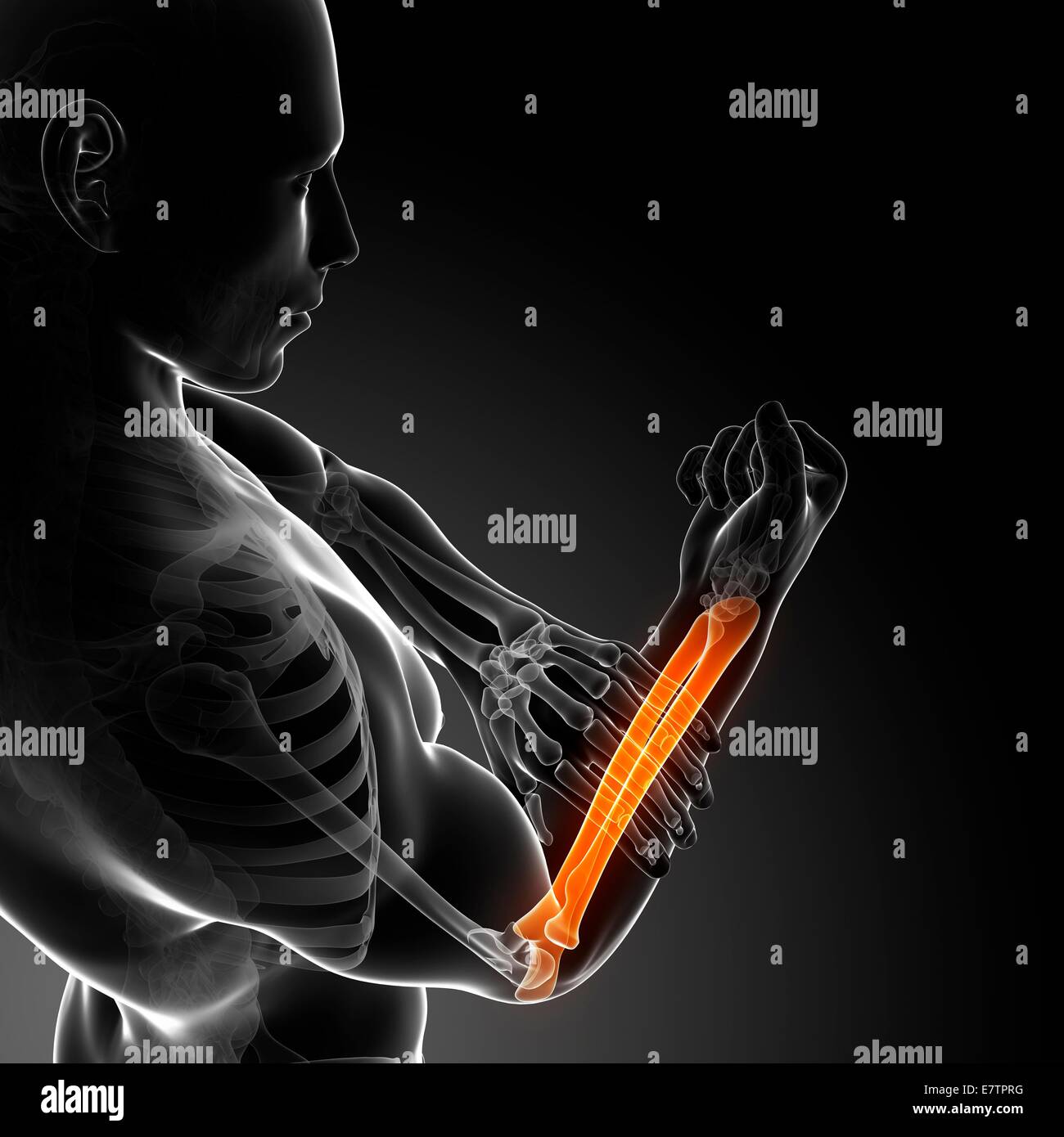 Human arm pain, computer artwork Stock Photo - Alamy