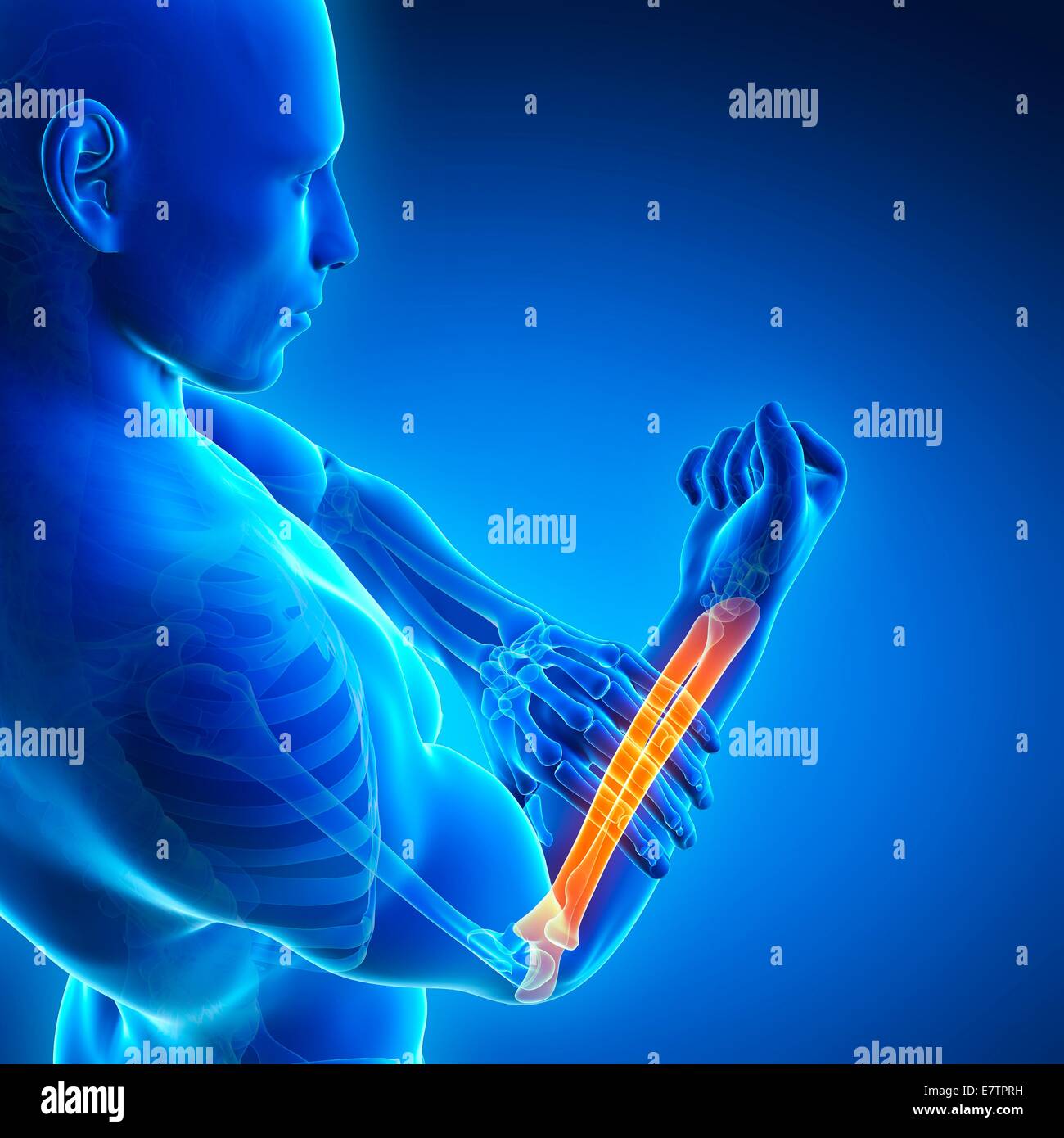Human arm pain, computer artwork Stock Photo - Alamy