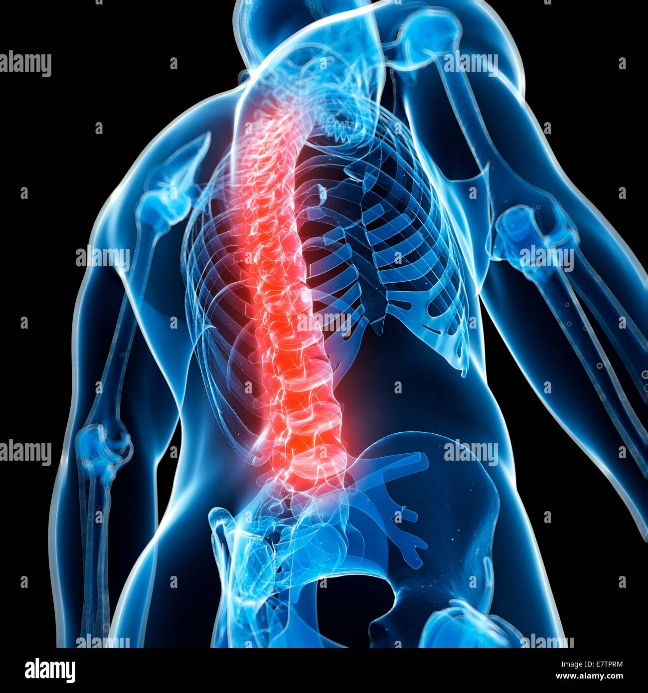 Human back pain, computer artwork Stock Photo - Alamy