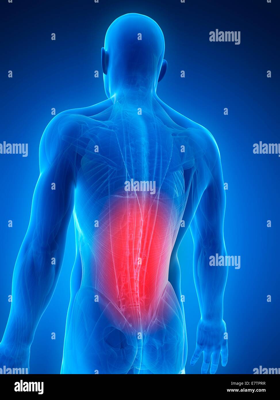 Human back pain, computer artwork Stock Photo - Alamy