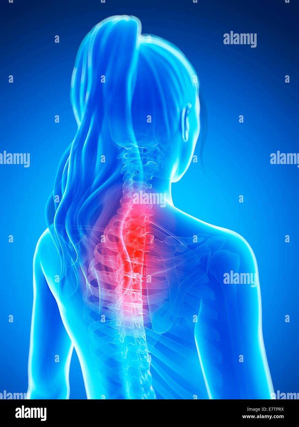 Neck pain computer artwork hi-res stock photography and images - Alamy