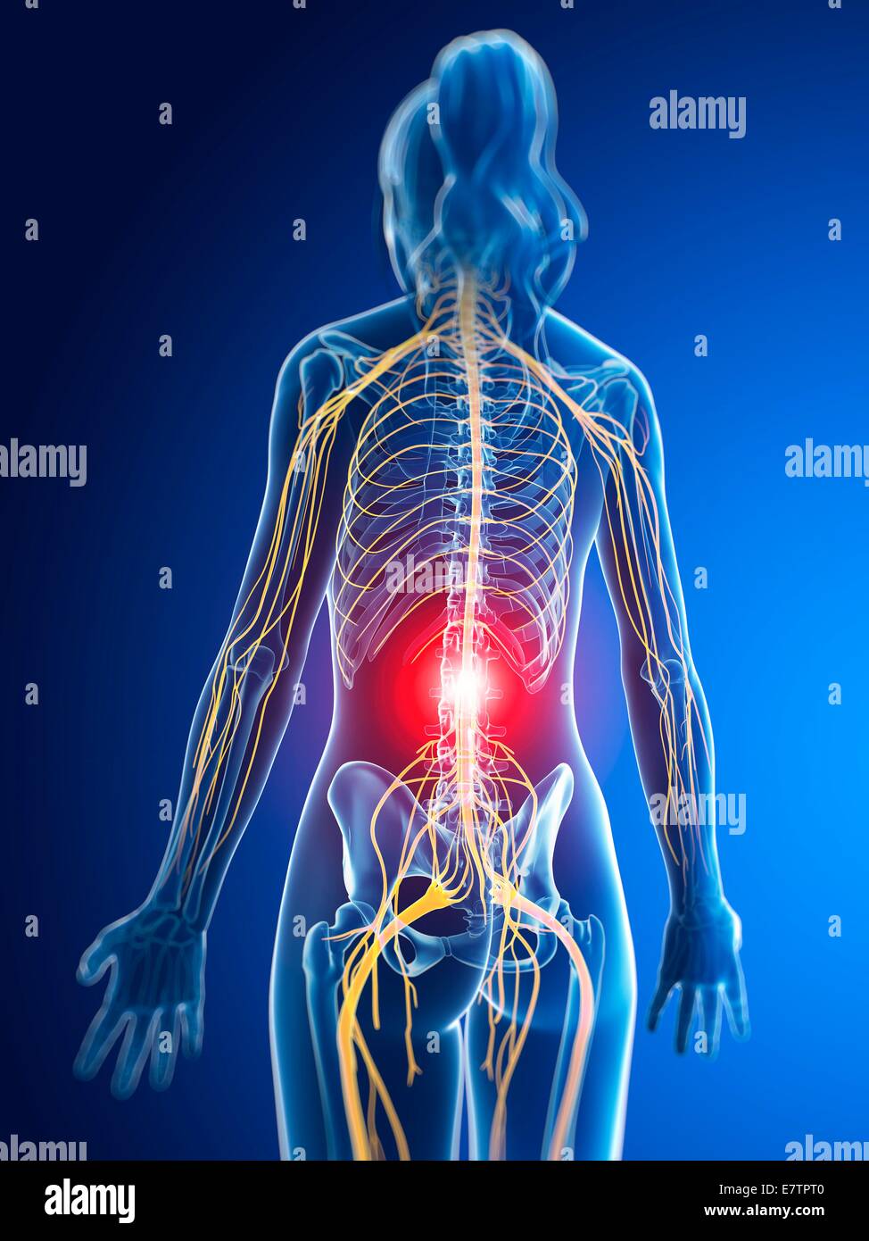 Human nerve pain, computer artwork Stock Photo - Alamy