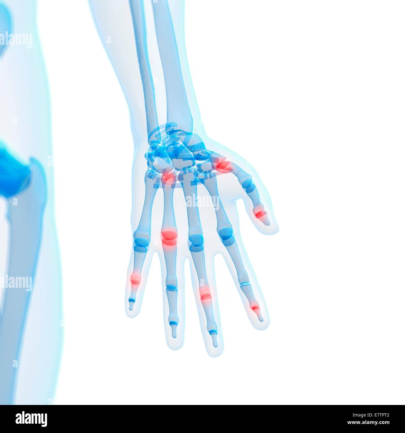 Finger bones and joints hi-res stock photography and images - Alamy