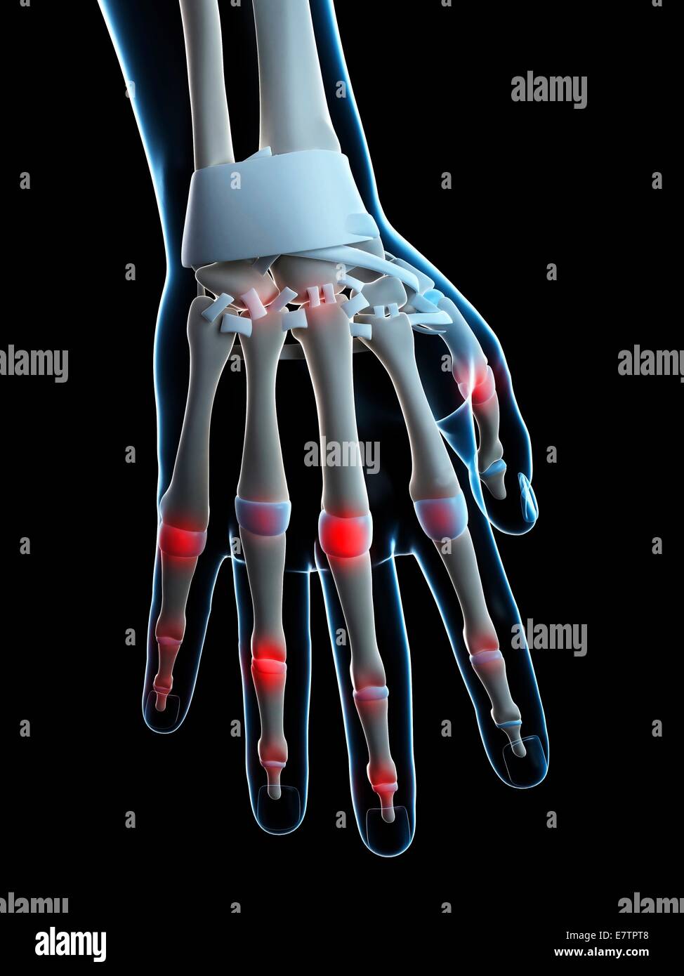 Finger bones and joints hi-res stock photography and images - Alamy