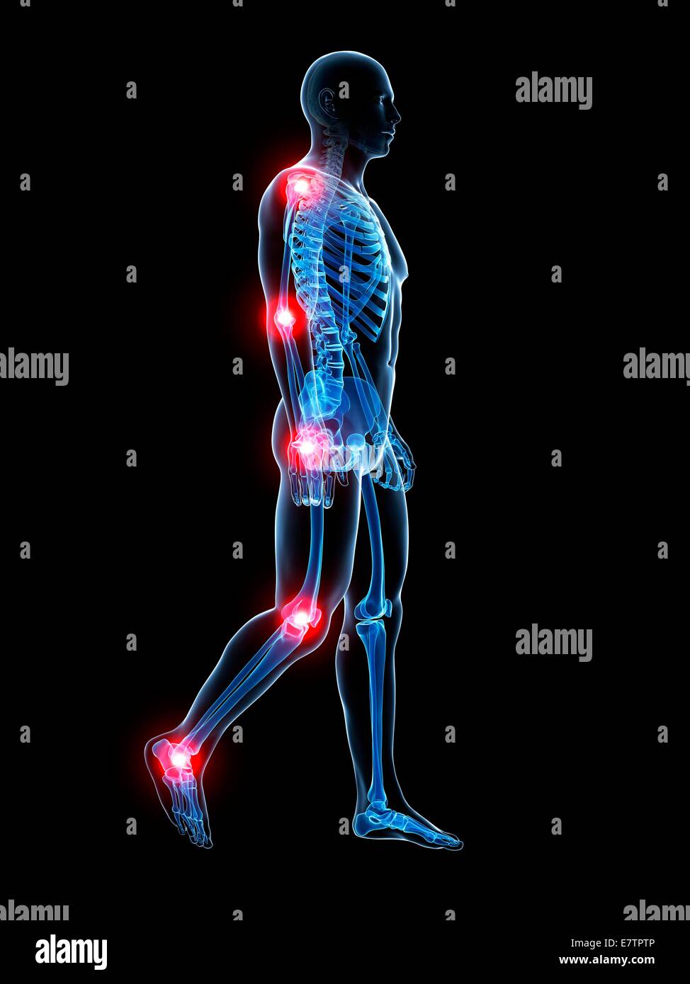 Human joint hi-res stock photography and images - Alamy