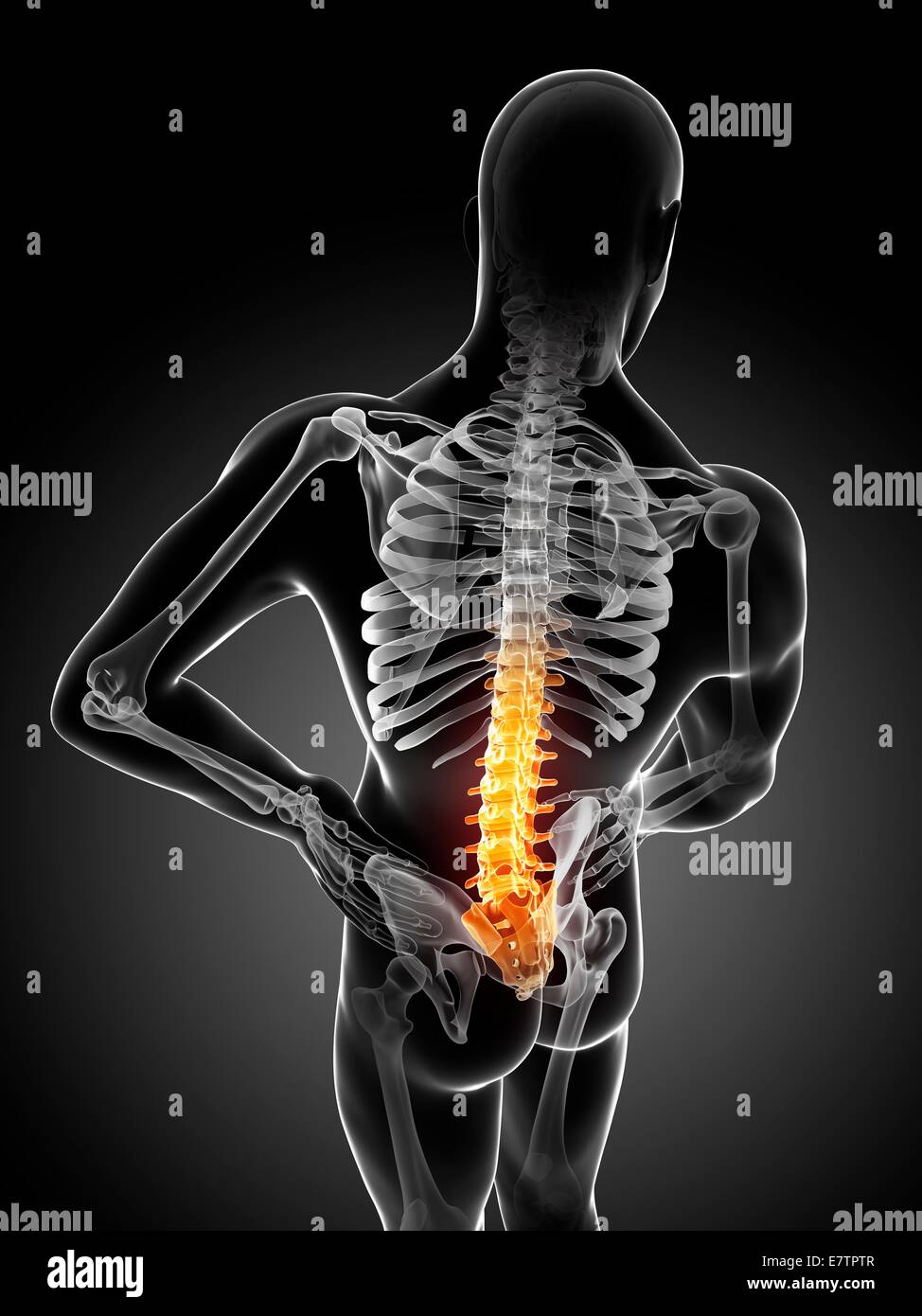 Human back pain, computer artwork Stock Photo - Alamy