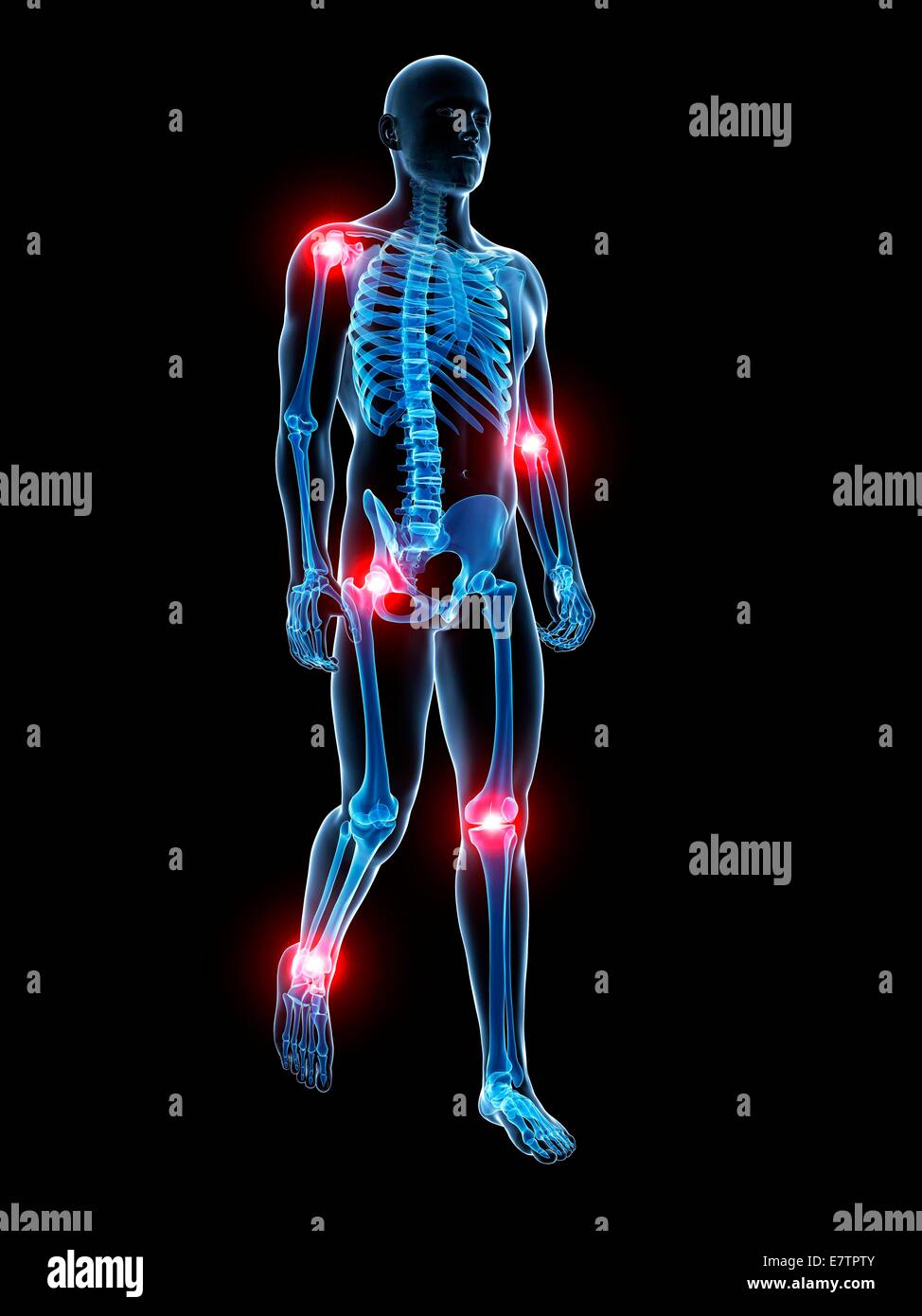 Human joint hi-res stock photography and images - Alamy