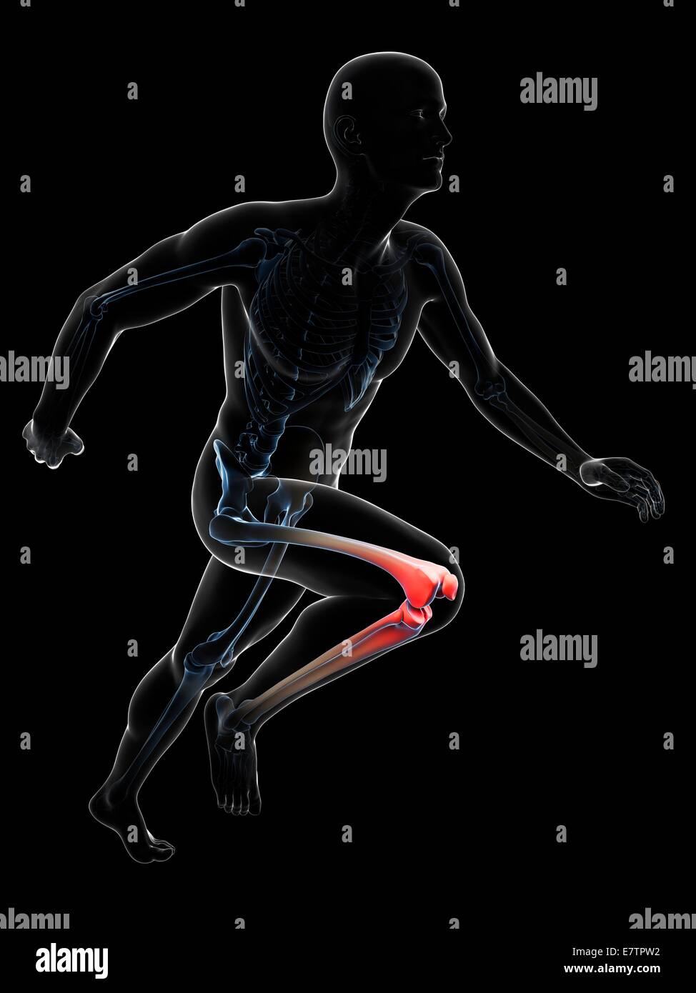 Runner's knee joint, computer artwork Stock Photo - Alamy