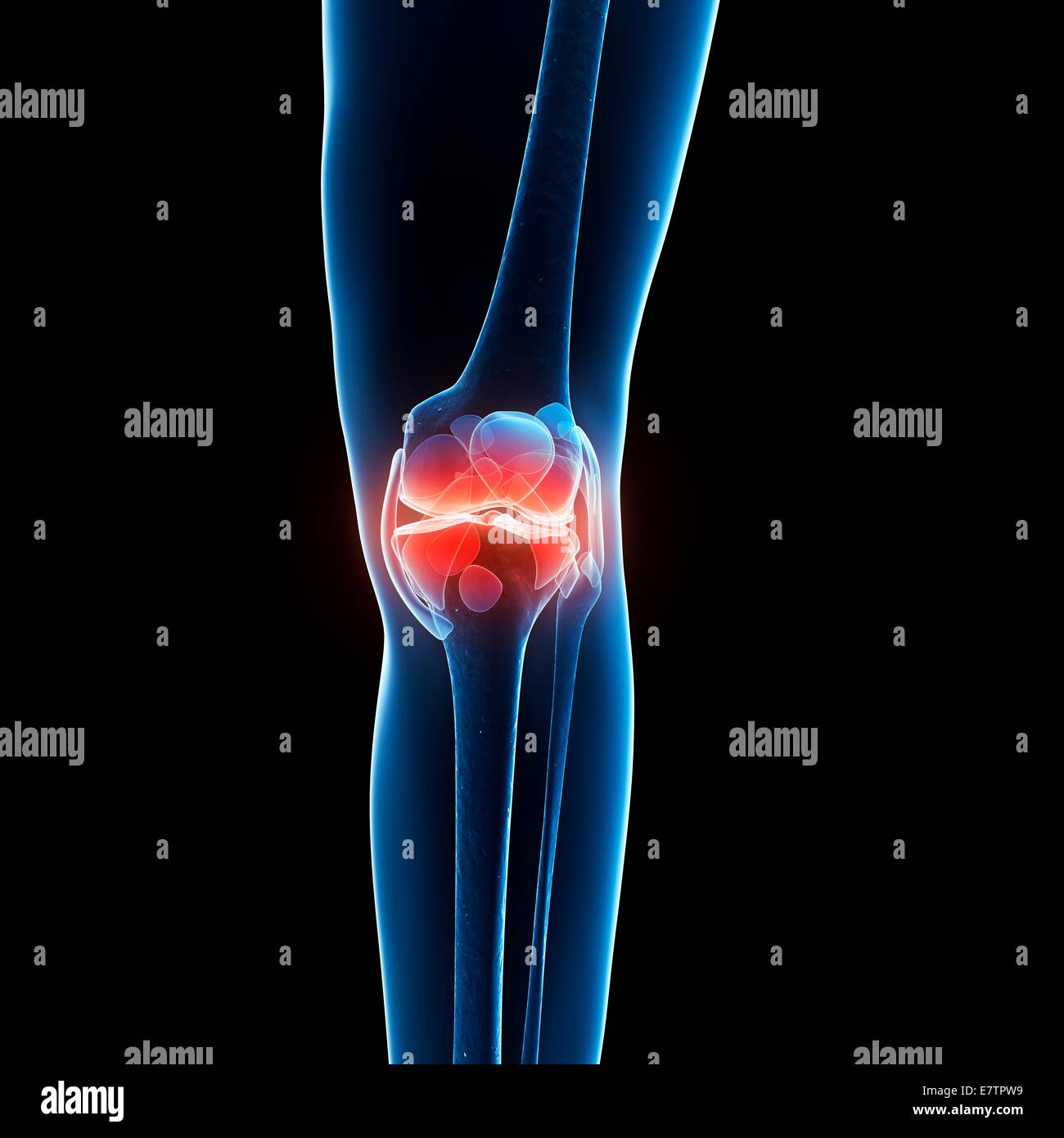Human knee pain, computer artwork Stock Photo - Alamy