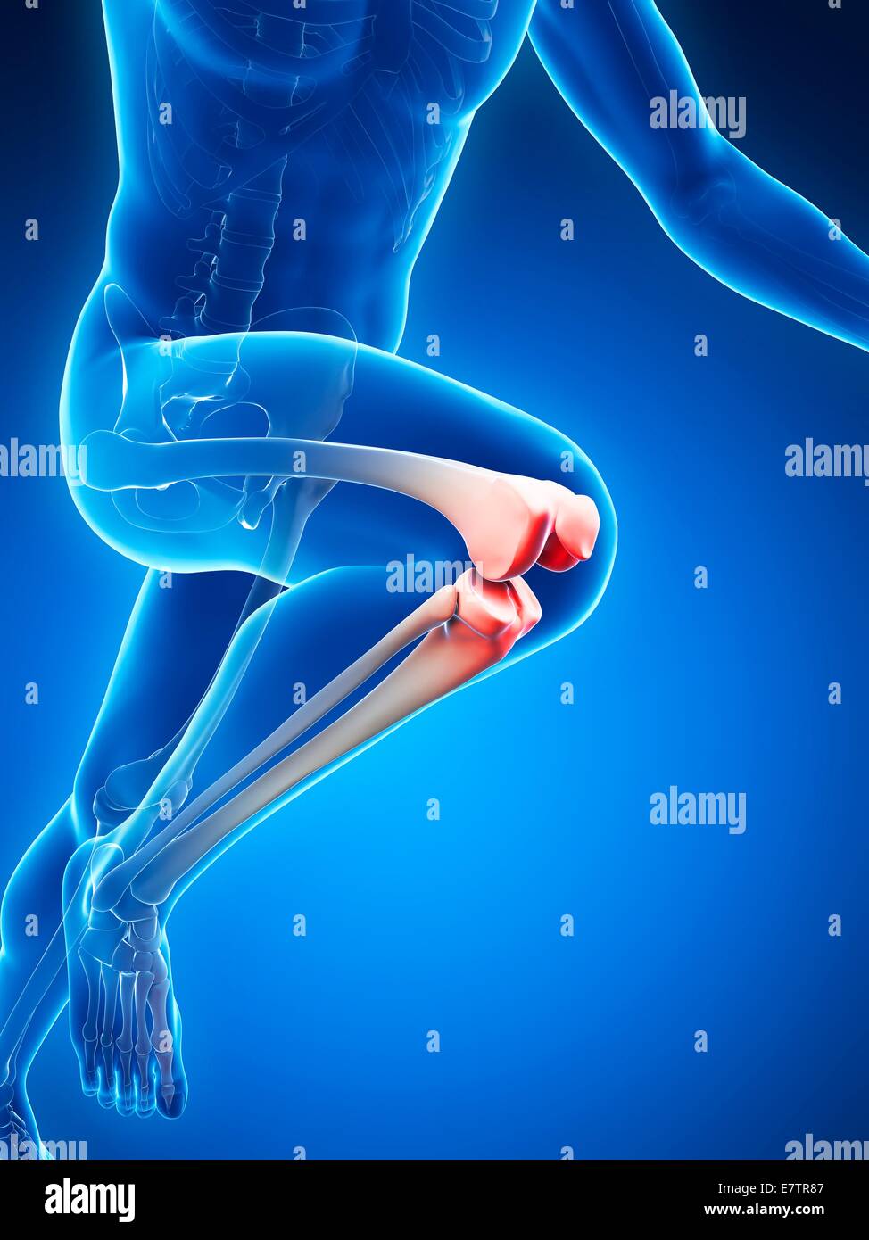 Runner's knee joint, computer artwork Stock Photo - Alamy