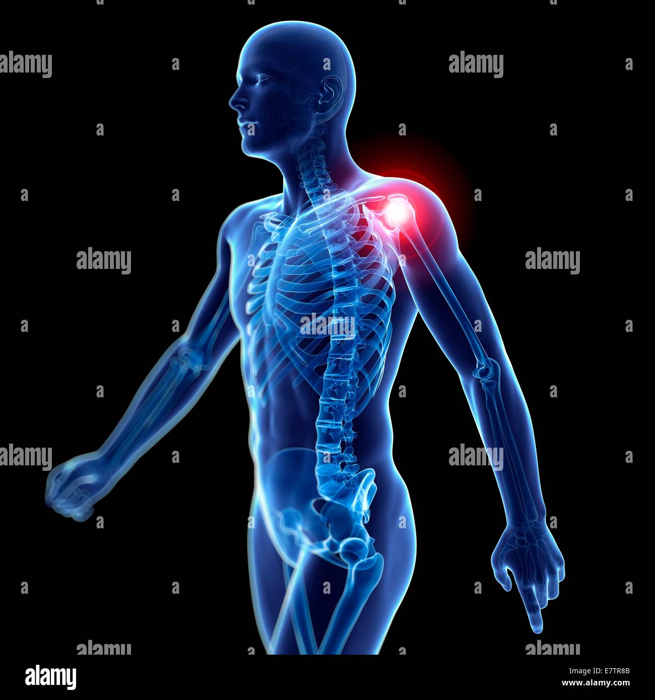 Shoulder pain and computer hi-res stock photography and images - Alamy