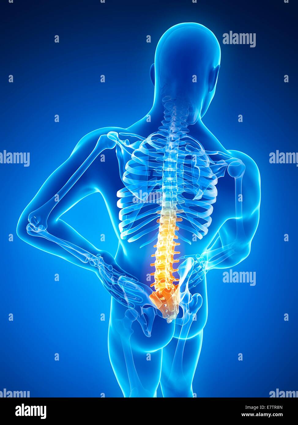Human back pain, computer artwork Stock Photo - Alamy