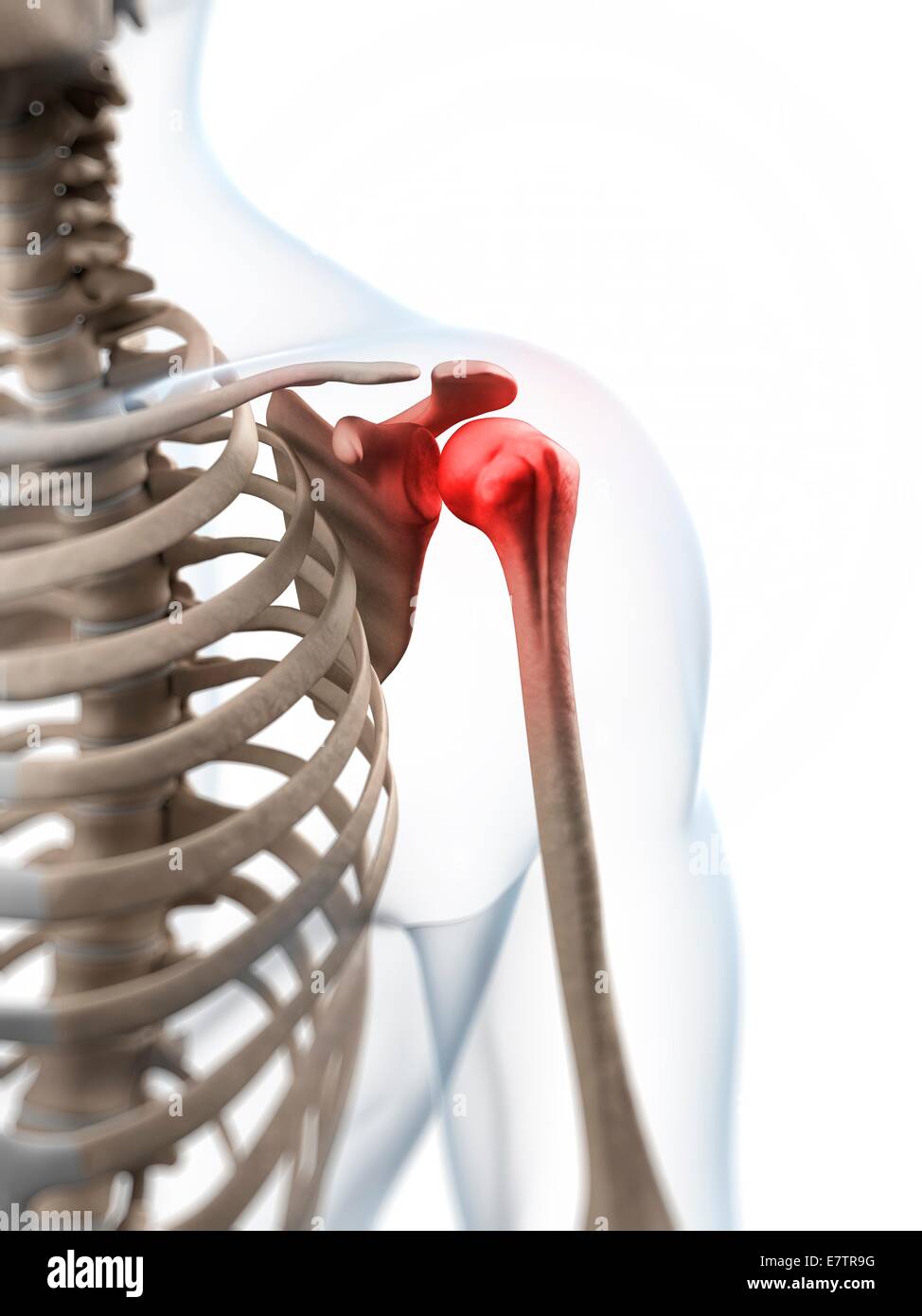 Human shoulder pain, computer artwork Stock Photo - Alamy